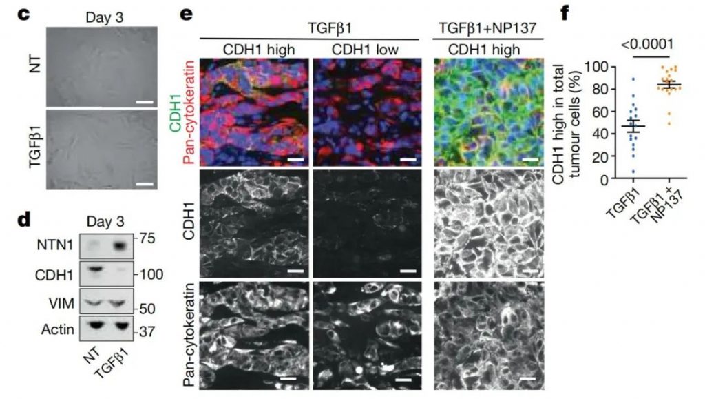 Nature：药理靶向netrin-1可抑制癌症的EMT - 每日生物评论
