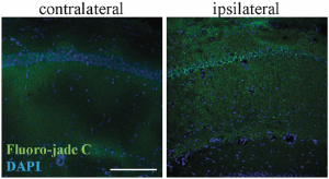 退化神经元染色试剂盒-Fluoro-Jade C (FJC)（绿色荧光） - 每日生物评论