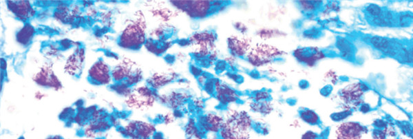 Scytek新品来袭，各种菌类特殊染色试剂盒一站式解决方案 - 每日生物评论