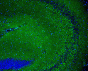 神经生长，修复再生？突触素（Synaptophysin）抗体的秘密 - 每日生物评论