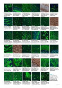 NSC研究丨神经干细胞标志物鉴定方案来了~ - 每日生物评论