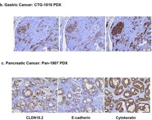 Claudin-18：肿瘤学的治疗靶点 - 每日生物评论